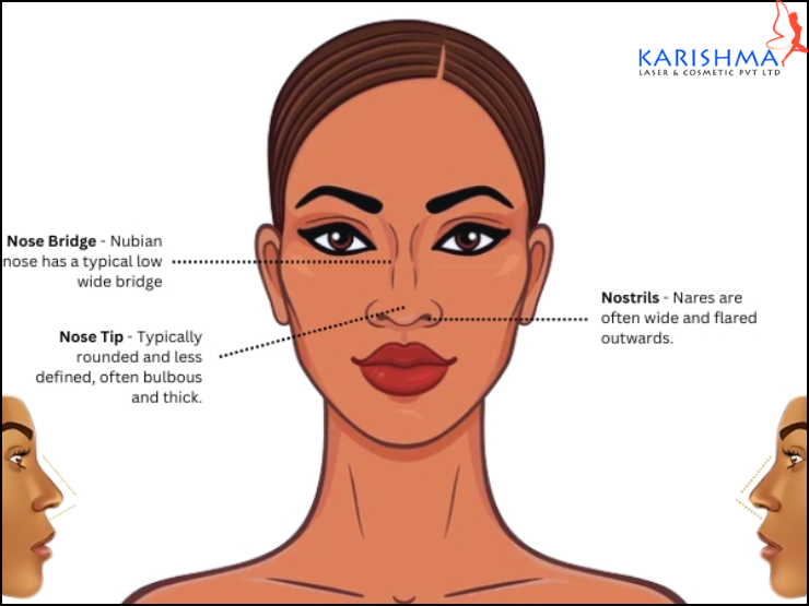 Types Of Noses - How Many Types Of Noses Are There?