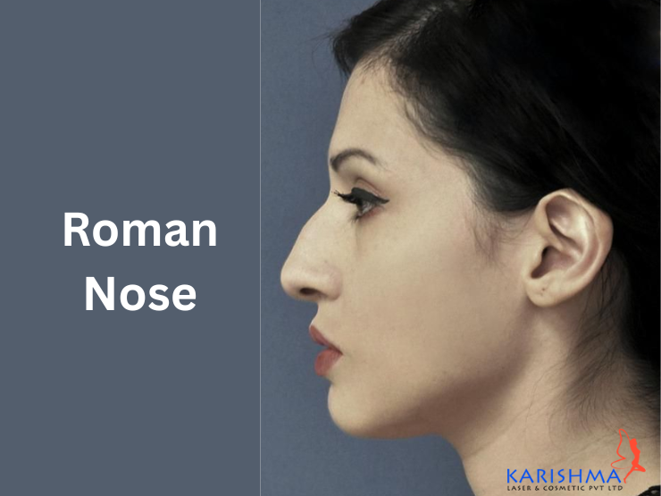 Types Of Noses - How Many Types Of Noses Are There?